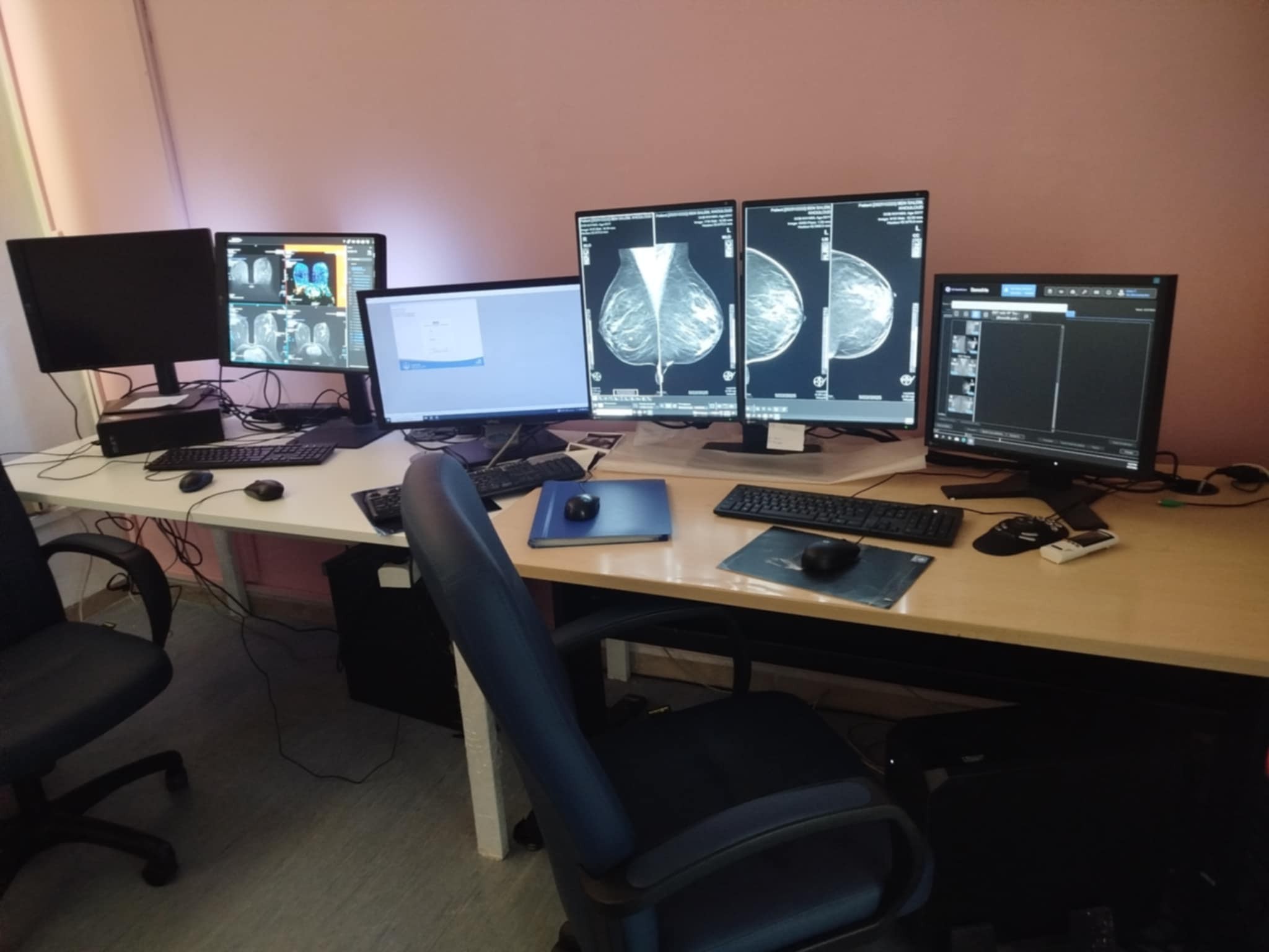 Ben Arous hospital upgrades with high-tech medical equipment - Tunisie